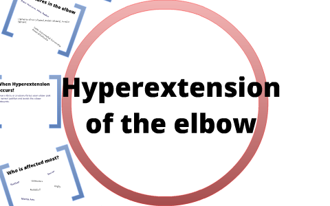 Hyperextension of the elbow by Caitlynn Southerland on Prezi