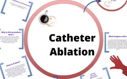Catheter Ablation by Casey Curtin on Prezi