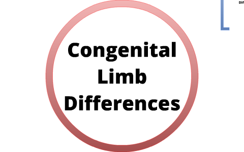 Congenital Limb Differences by Chris Jared