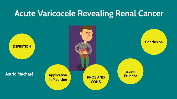 Acute Varicocele Revealing Renal Cancer by Astrid Machare on Prezi