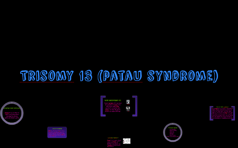 Trisomy 13 (patau syndrome) by Kathryn Diel on Prezi