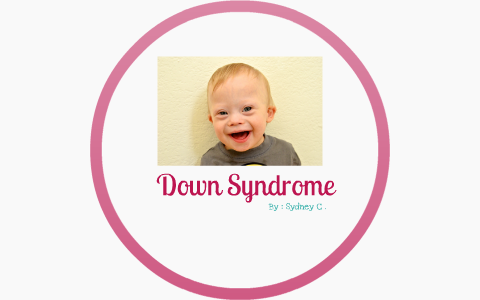 Dpwn Syndrome . by Sydney C. on Prezi