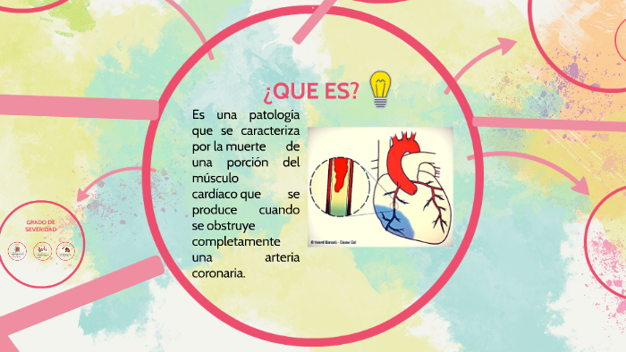 INFARTO AGUDO DEL MIOCARDIO by Jennifer Canizales on Prezi