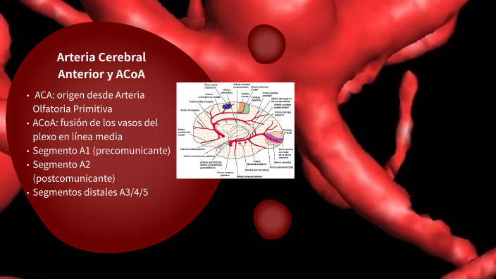 Aneurisma acoa by Jazmín Fraire on Prezi