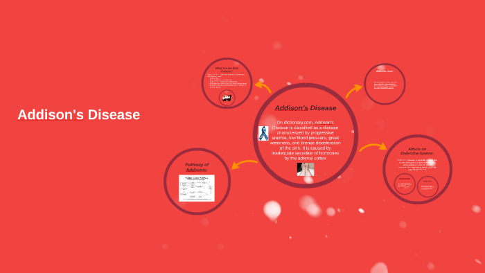 Addison's Disease by Megan Dunn on Prezi