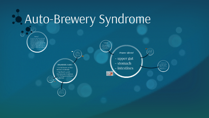 Auto-Brewery by Griffin Crawley on Prezi