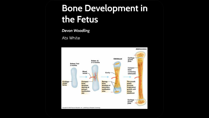 Bone Development of the Fetus by Devon Woodling on Prezi
