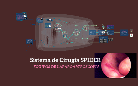Sistema de Cirugía SPIDER by Eliza Sierra on Prezi