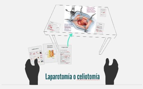 Laparotomía o celiotomía by on Prezi
