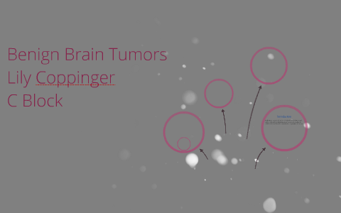 Benign Brain Tumors by Lily Coppinger on Prezi