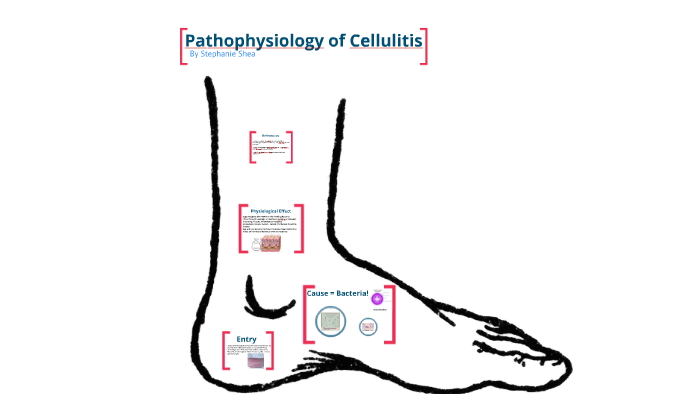 Pathophys Cellulitis by Stephanie Shea on Prezi