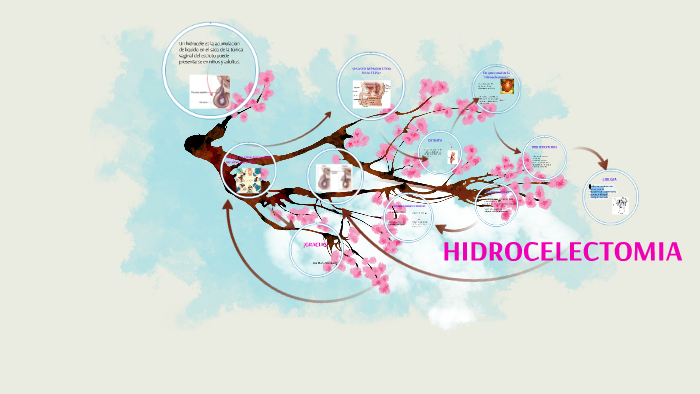 HIDROCELECTOMIA by ana maria martinez triana on Prezi