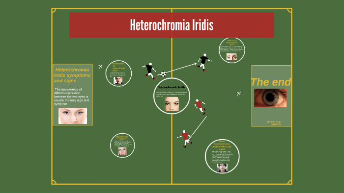 The difference between a hawks eye and a human eye by connor mcgreal on ...