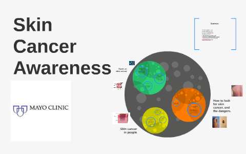 Skin Cancer Awareness by Blaise Adams on Prezi