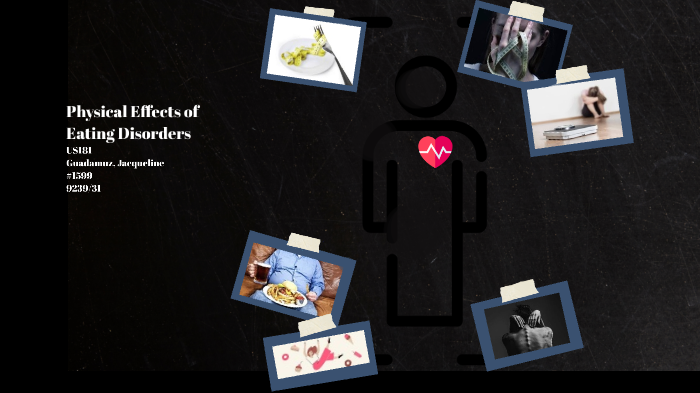 Physical Effects of Eating Disorders by jackie on Prezi