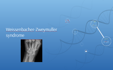 Weissenbacher-Zweymuller syndrome by Jade Ellis on Prezi