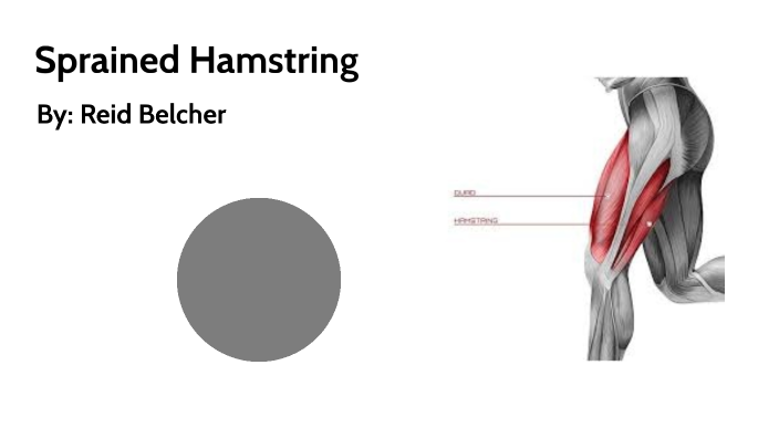 Sprained Hamstring by Reid Belcher on Prezi