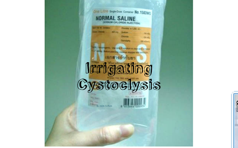 Irrigating Cystoclysis by Jessa Cultura on Prezi