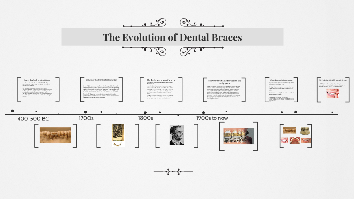 The Evolution of Dental Braces by Hannah Taormina on Prezi