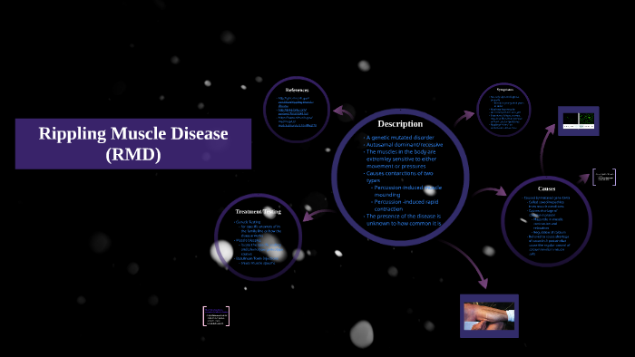 Rippling Muscle Disease by Robin Triggs on Prezi