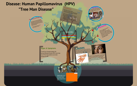 "Tree Man" by Pristyna Boonreuang on Prezi
