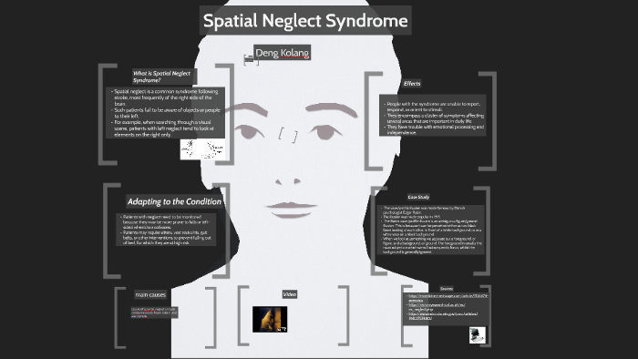 Spatial Neglect Syndrome by Deng kolang on Prezi