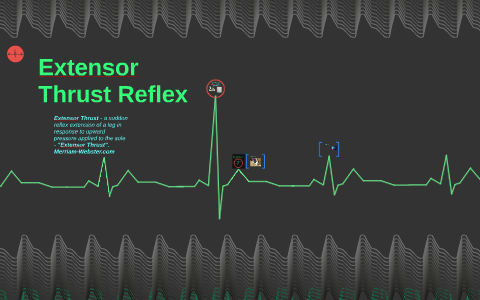 Extensor Thrust Reflex by Kellsey Hogan on Prezi