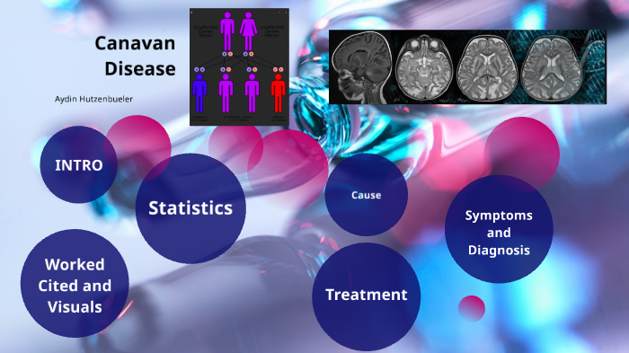 Canavan Disease by Aydin Hutzenbuehler on Prezi