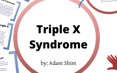 Triple X Syndrome by Adam Shim on Prezi