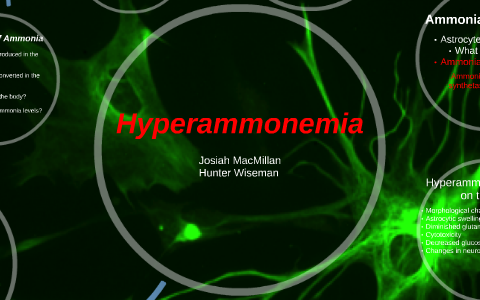 Hyperammonemia by Hunter Wiseman on Prezi