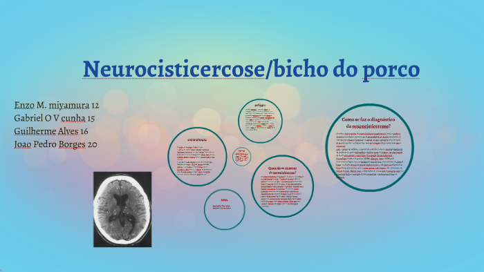 NEUROCISTICERCOSE by gabriel vargas on Prezi