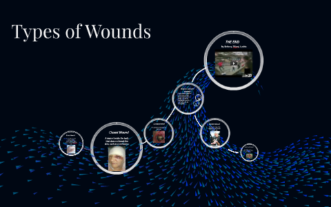 Types of Wounds by Cynthia Moore on Prezi