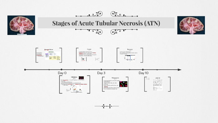 Stages of Acute Tubular Necrosis (ATN) by Mara Shapero on Prezi