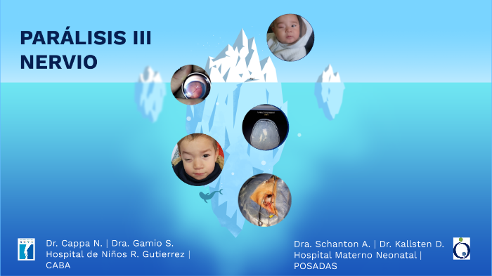 PARALISIS DEL III NERVIO by nicolas cappa on Prezi