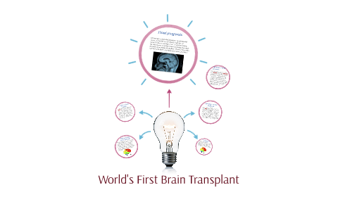 World's First Brain Transplant by Lexie Wedge on Prezi