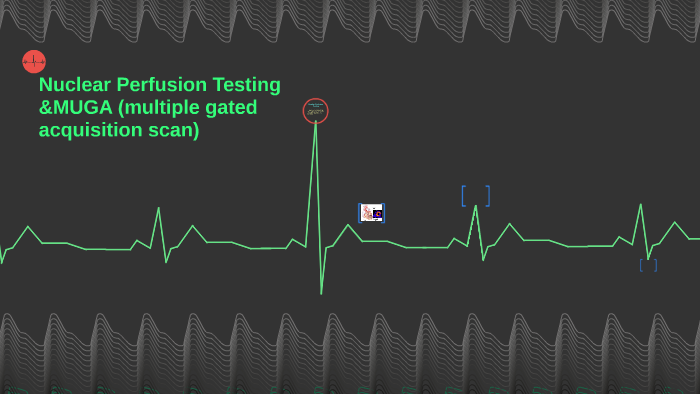 Nuclear Perfusion Testing &MUGA (multiple gated acquisition by Maeson ...