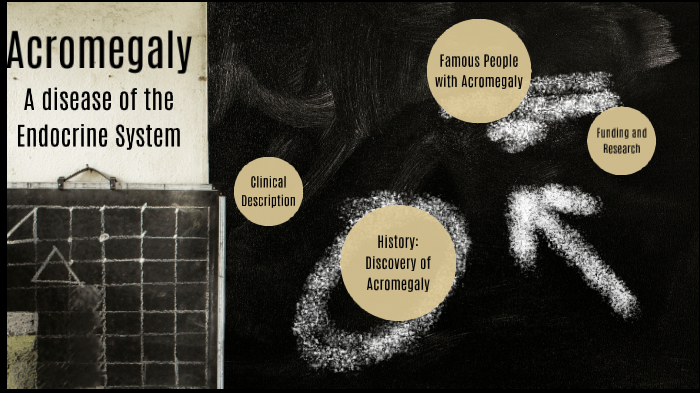 Acromegaly: A Disease of the Endocrine System by Bailey Helm on Prezi