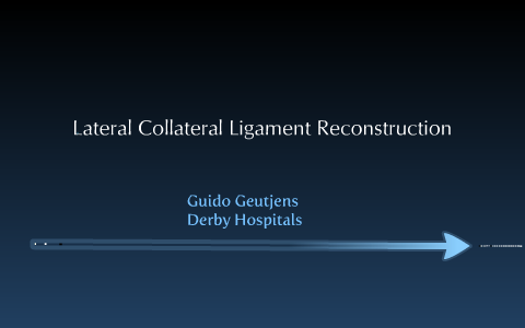 Lateral Collateral Ligament Reconstruction. by Guido Geutjens on Prezi