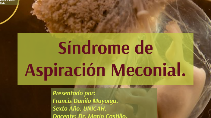 SINDROME DE ASPIRACION DE MECONIAL. by cesar mayorga on Prezi