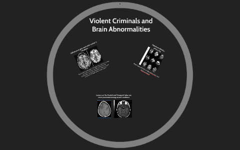 Violent Crime and Brain Abnormalities by Cameron Noland on Prezi