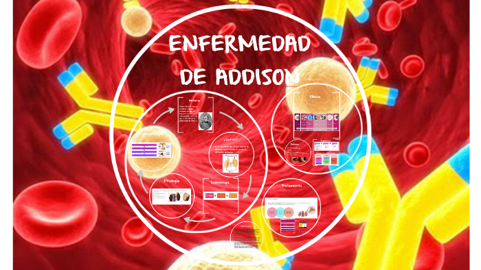 ENFERMEDAD DE ADDISON by maria amore on Prezi