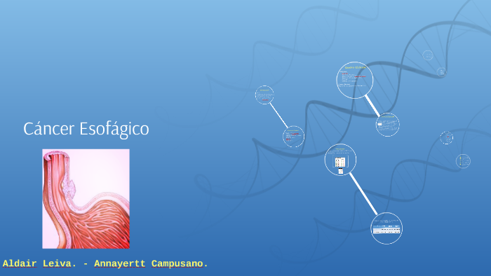 Cancer Esofagico by Annayertt Madariaga on Prezi