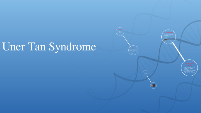 Uner Tan Syndrome by gabby rudzik on Prezi