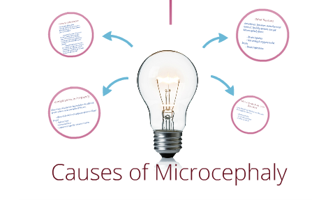 Microcephaly: Causes and Preventions by Gabby B. on Prezi