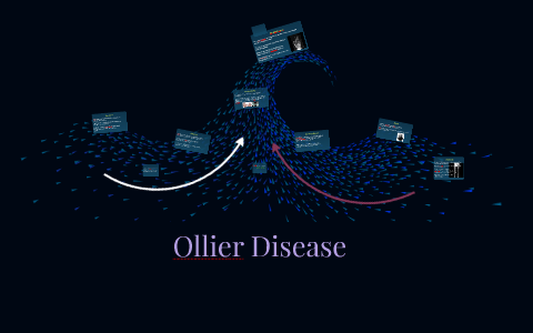 Ollier Disease by Jacob Moore on Prezi