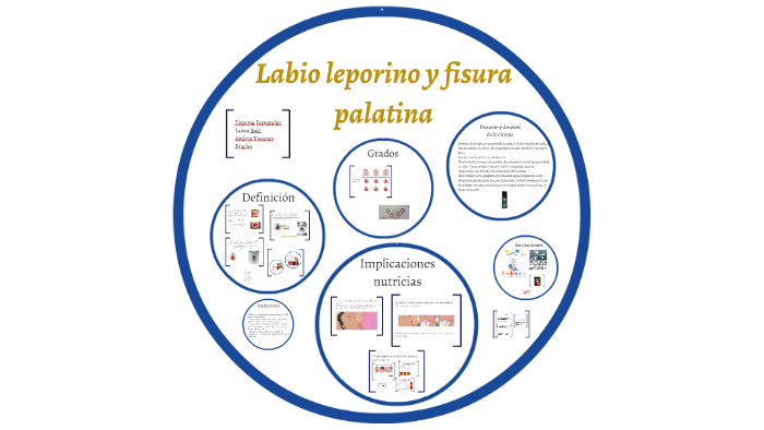 Labio leporino y paladar by Andrea Bracho on Prezi