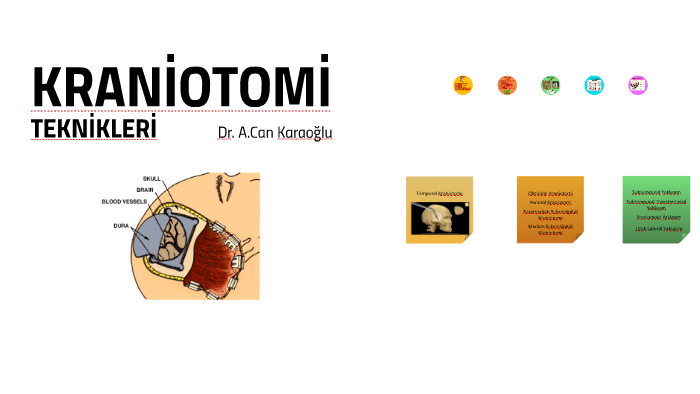 KRANİOTOMİ by Adil Can Karaoğlu on Prezi