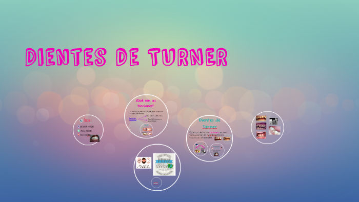 Dientes de TURNER by on Prezi