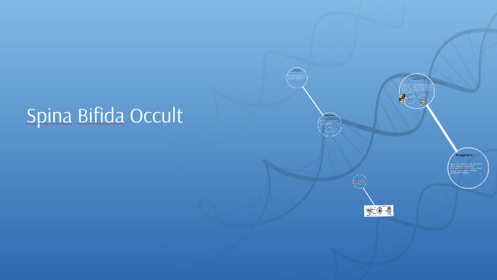 Spina Bifida Occult by tionne thrasher on Prezi