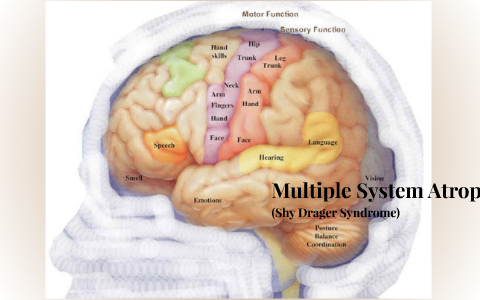 Multiple System Atrophy by Hope Liechty on Prezi